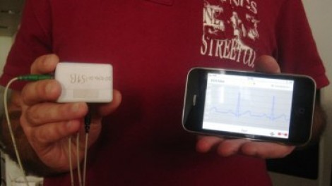 Wireless Electrocardiography… With IPhone | Hackaday