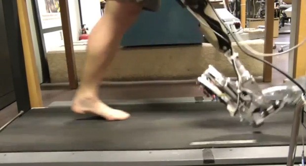 Prosthetic Foot And Ankle Have Amazingly Natural Movement | Hackaday