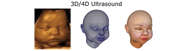 As anyone with a Facebook account that’s over the age of 25 will tell you, 3D ultrasounds of ...