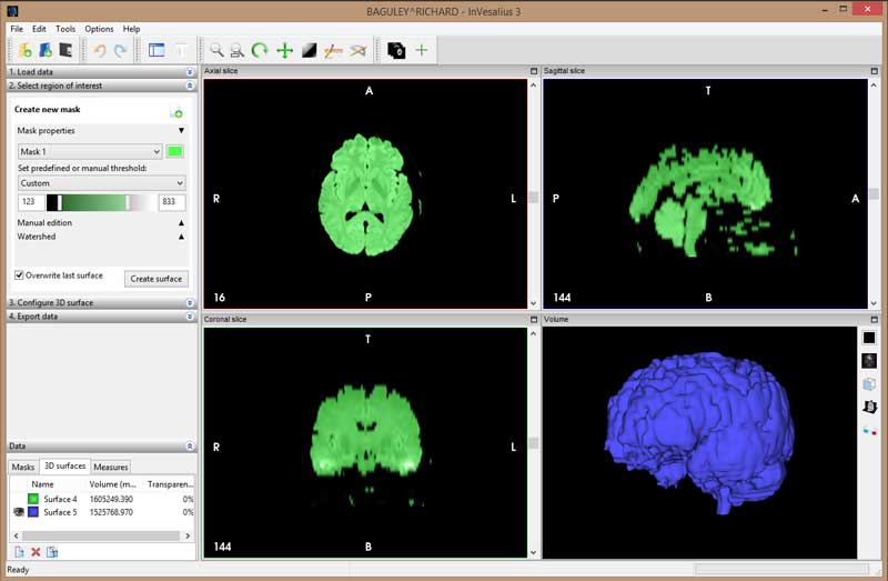 You Own Your MRI Brainscan; Do Something Interesting With It | Hackaday