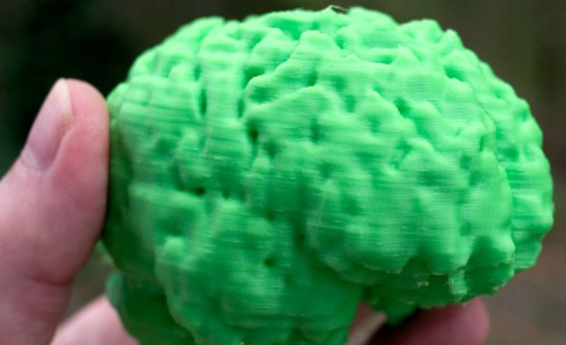 You Own Your MRI Brainscan; Do Something Interesting With It | Hackaday