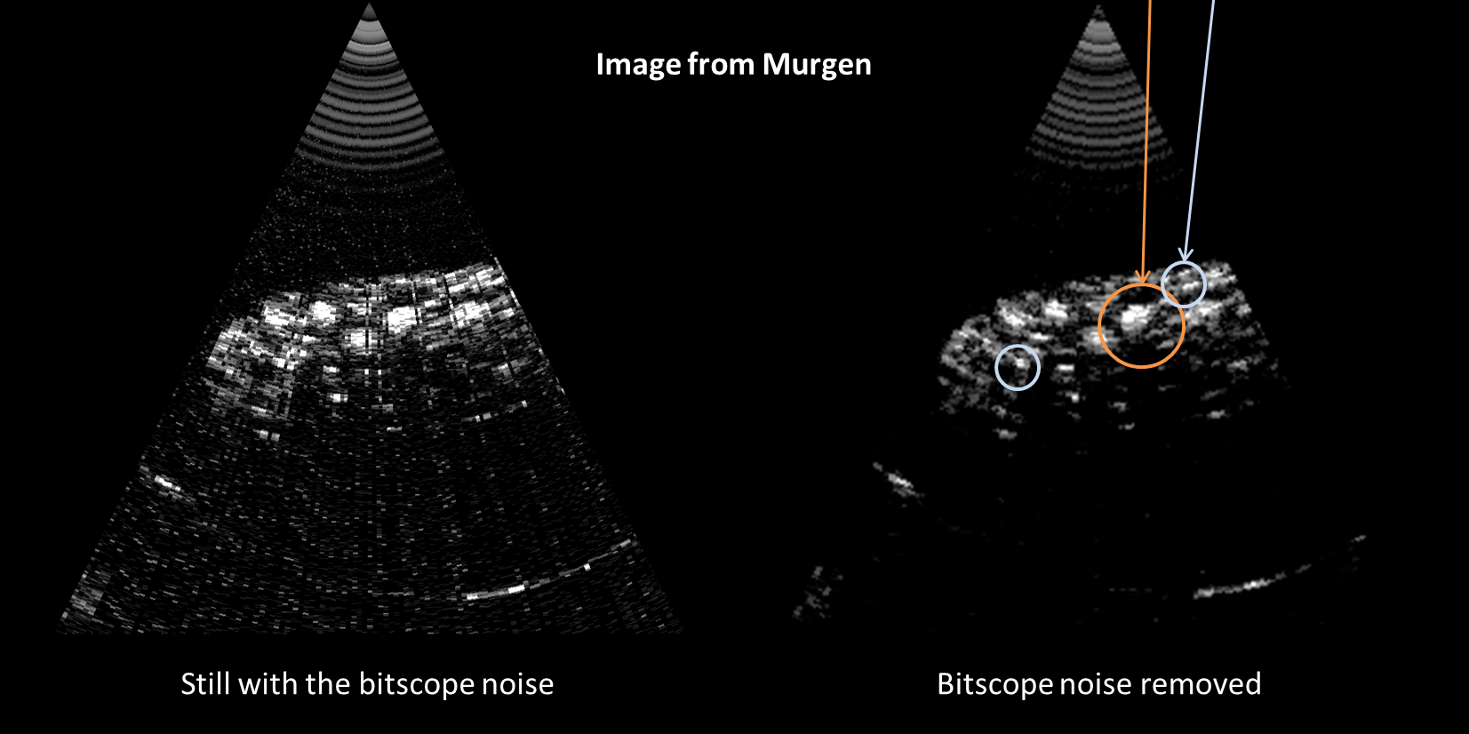 A Developer’s Kit For Medical Ultrasound | Hackaday