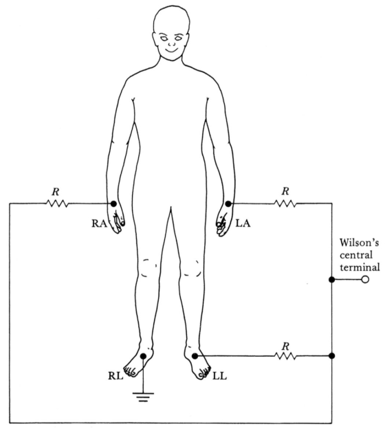 Saving Lives With Open-Source Electrocardiography | Hackaday