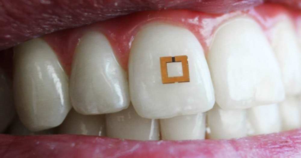 The IoT (Internet Of Teeth) | Hackaday