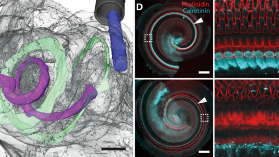 Shining A Light On Hearing Loss | Hackaday