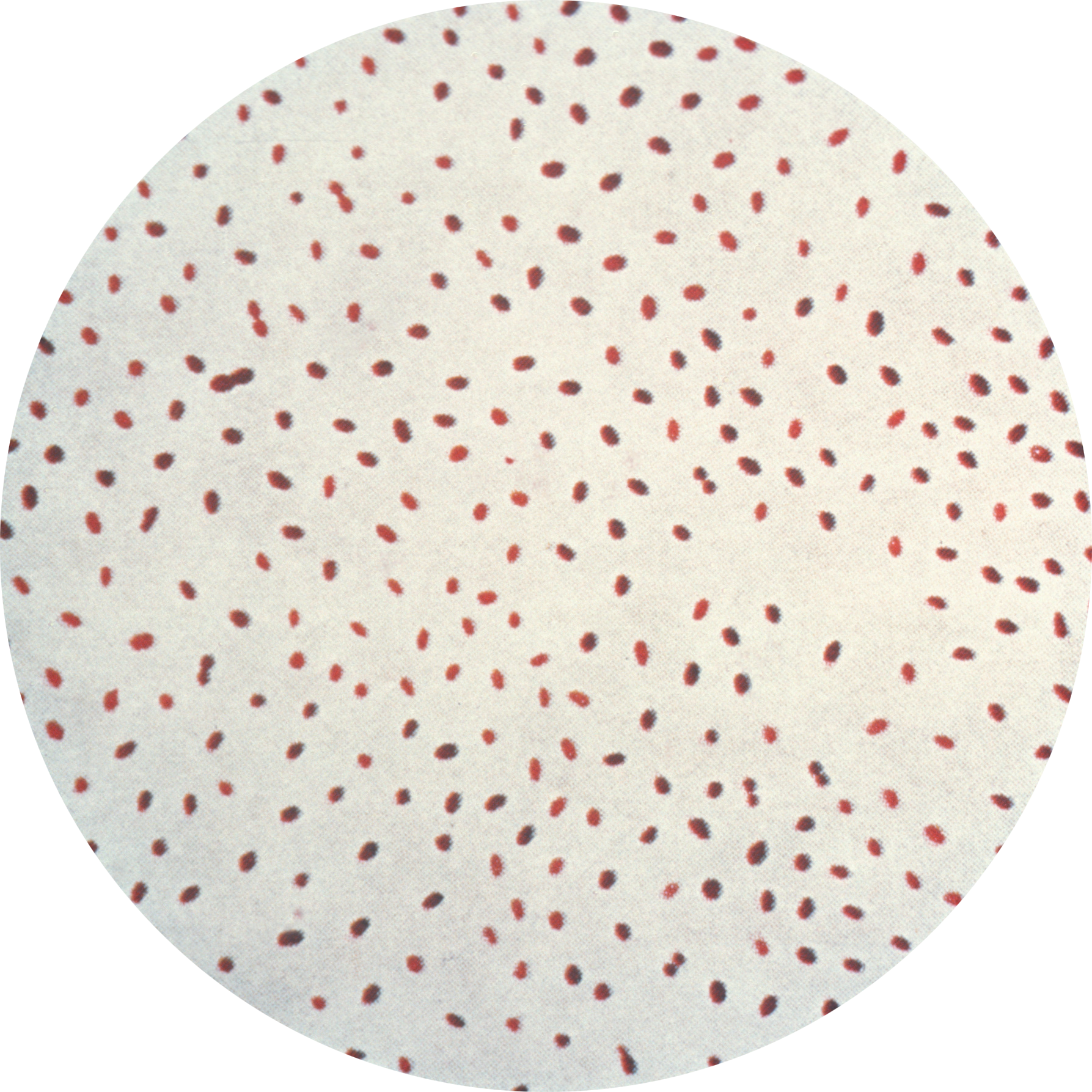 Alice Evans: Brucellosis, Or Why We Pasteurize Milk | Hackaday