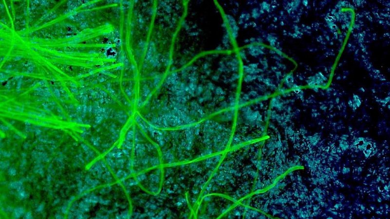 See Cells In A New Light With A DIY Fluorescence Microscope | Hackaday