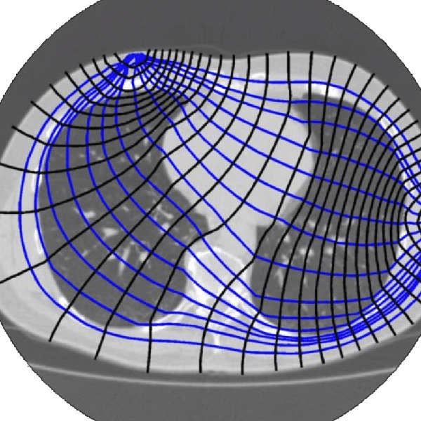 Tomography Through An Infinite Grid Of Resistors | Hackaday