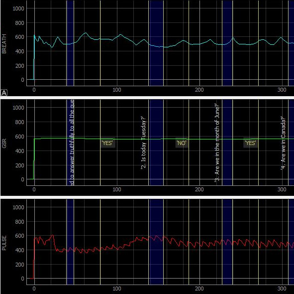 Arduino Polygraph Shows How It’s Done | Hackaday
