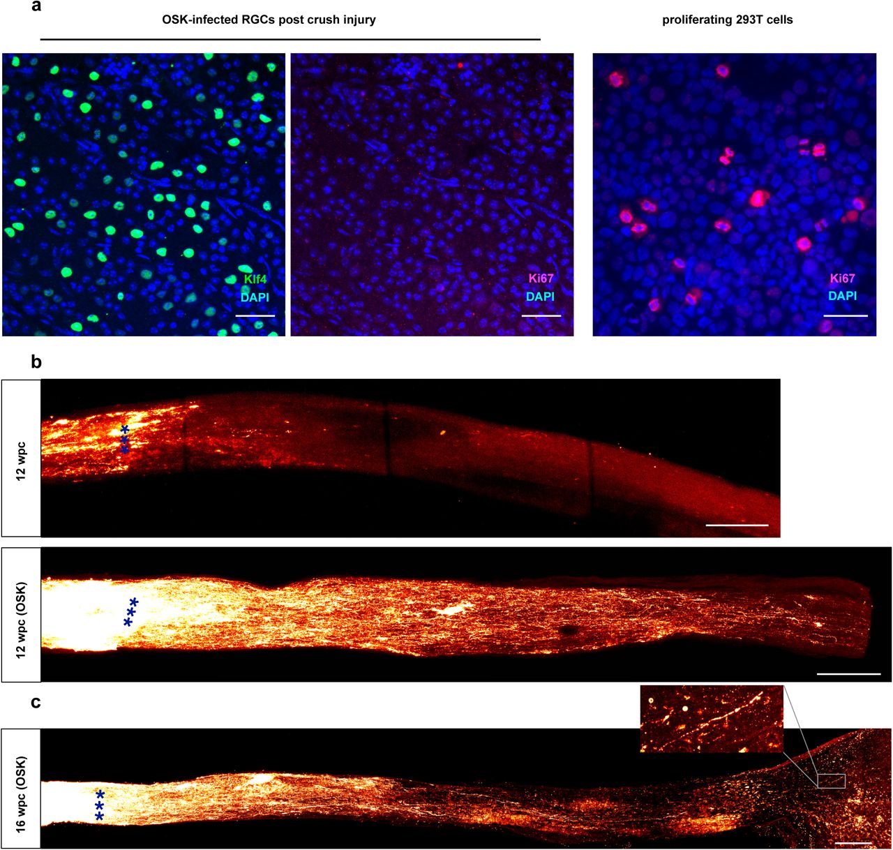 Seeking Enlightenment: The Quest To Restore Vision In Humans | Hackaday