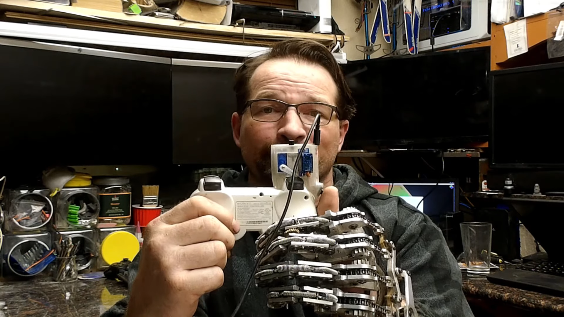 Console Controller Mod Gets Amputee Back In The Game | Hackaday