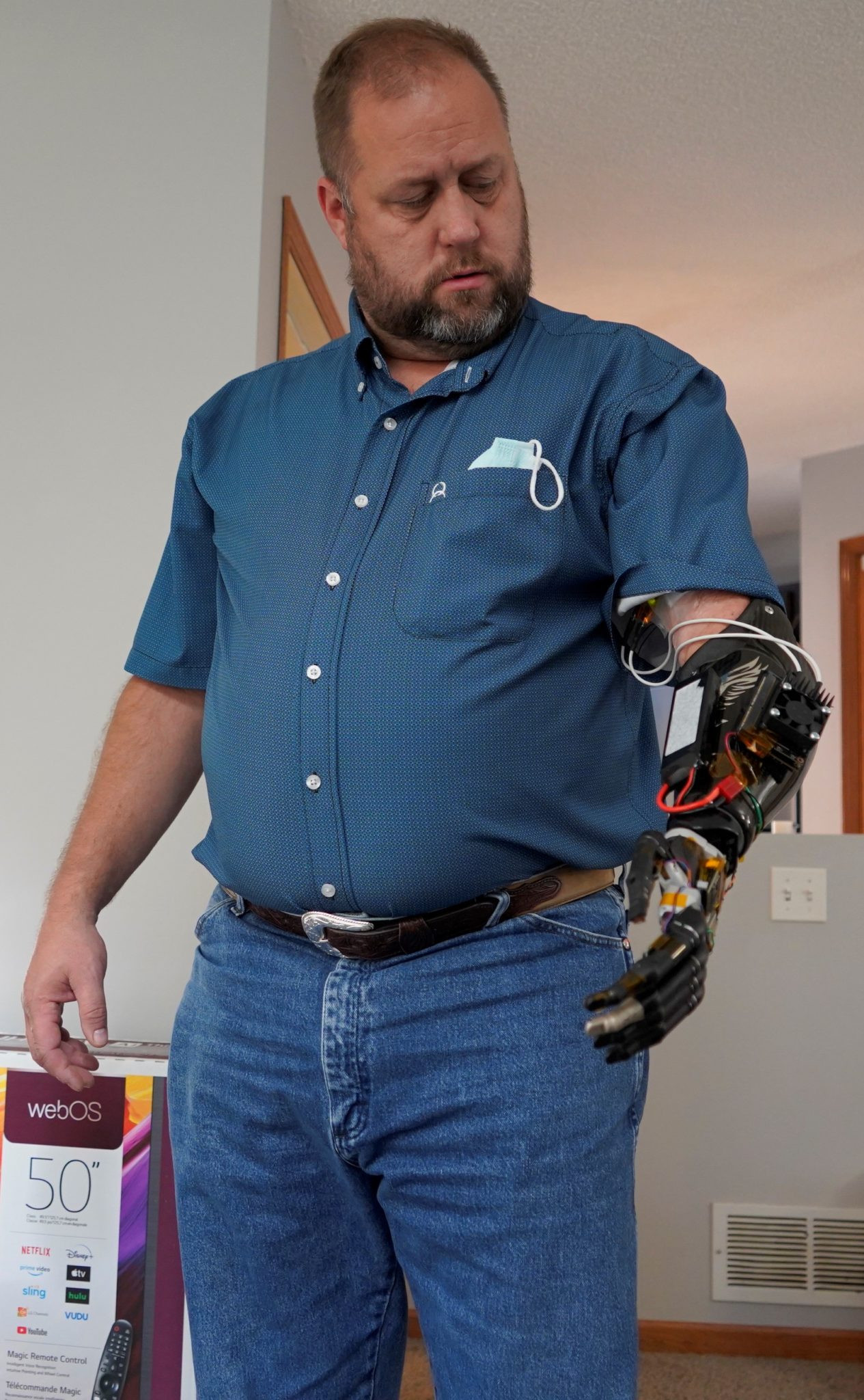 Sims 4 Prosthetic Arm