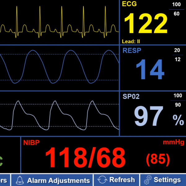 What Can We Do With These Patient Monitor Videos Hackaday